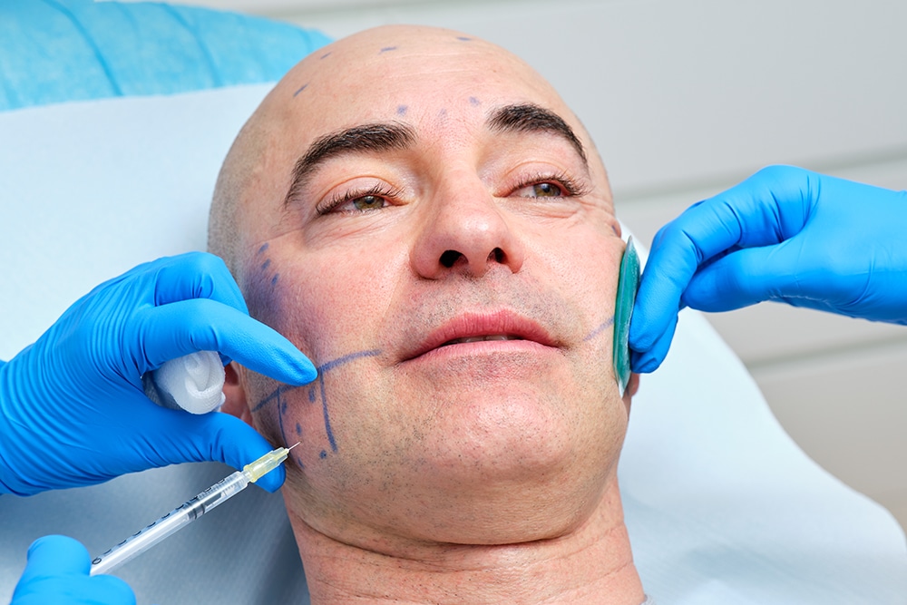 Male Facelift for a Youthful, Defined Appearance