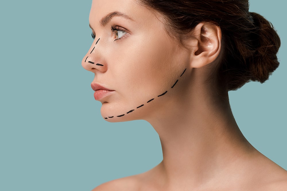 Chin Implant for Enhanced Facial Balance