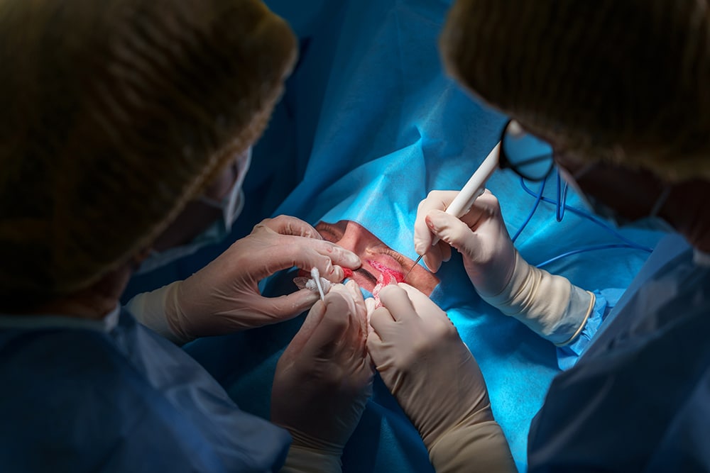 Temple Implant for Facial Contouring and Balance